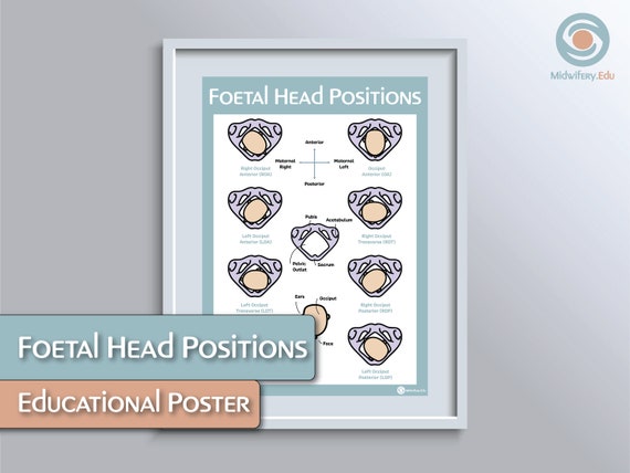 Foetal/fetal Head Position Educational Poster - Etsy