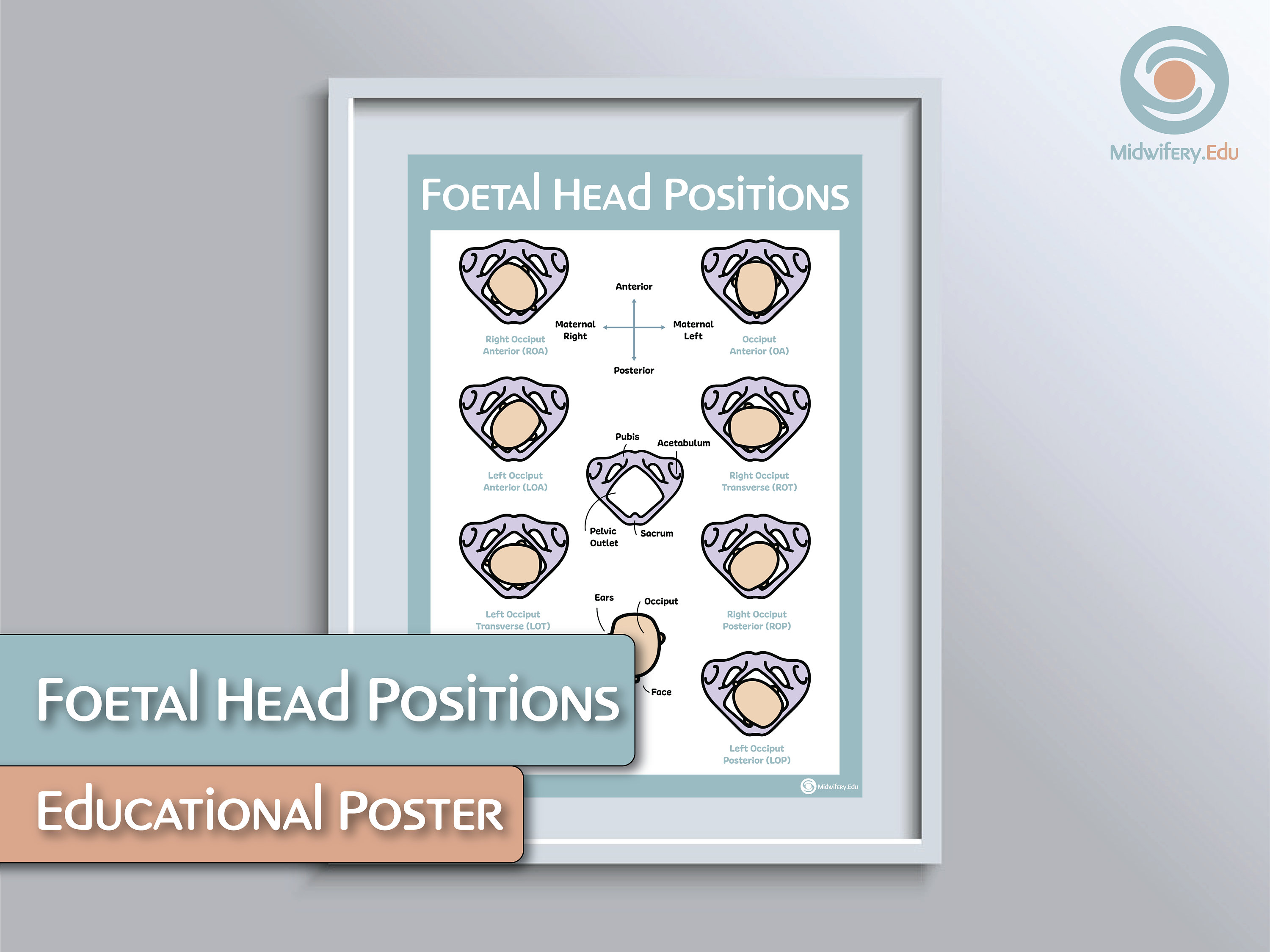 Foetal/fetal Head Position Educational Poster - Etsy UK