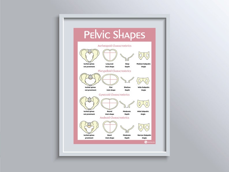Pelvic Shape Educational Poster - Etsy
