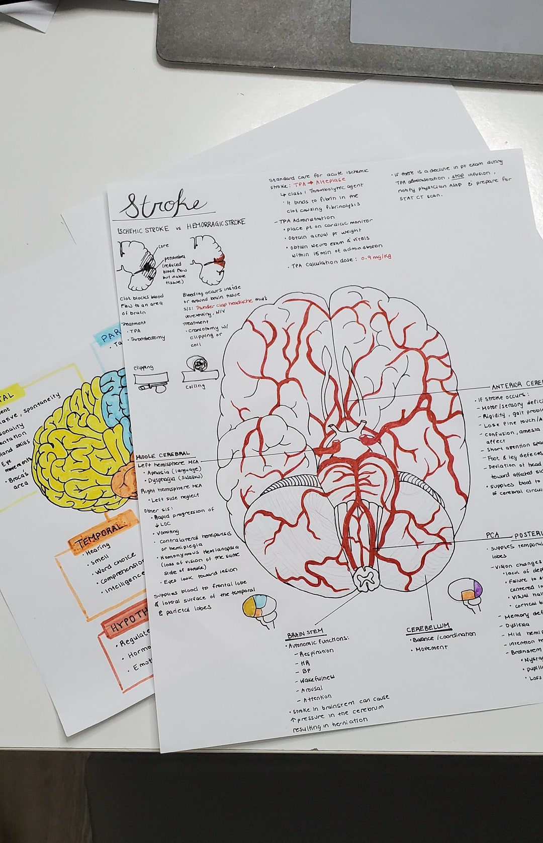 Stroke and Its Effects - Handwritten Notes - Etsy