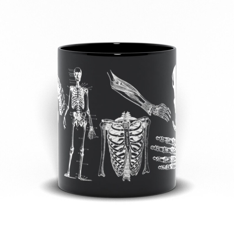 Custom Anatomy Mug Anatomy Gift Surgeon Coffee Mug | Etsy