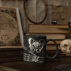 Custom Anatomy Mug, Anatomy Gift, Surgeon Coffee Mug, Orthopedic Gift ...