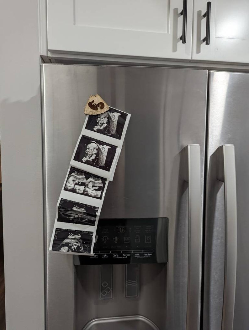 Ultrasound Magnet Custom Baby Scan Refrigerator Magnet | Etsy