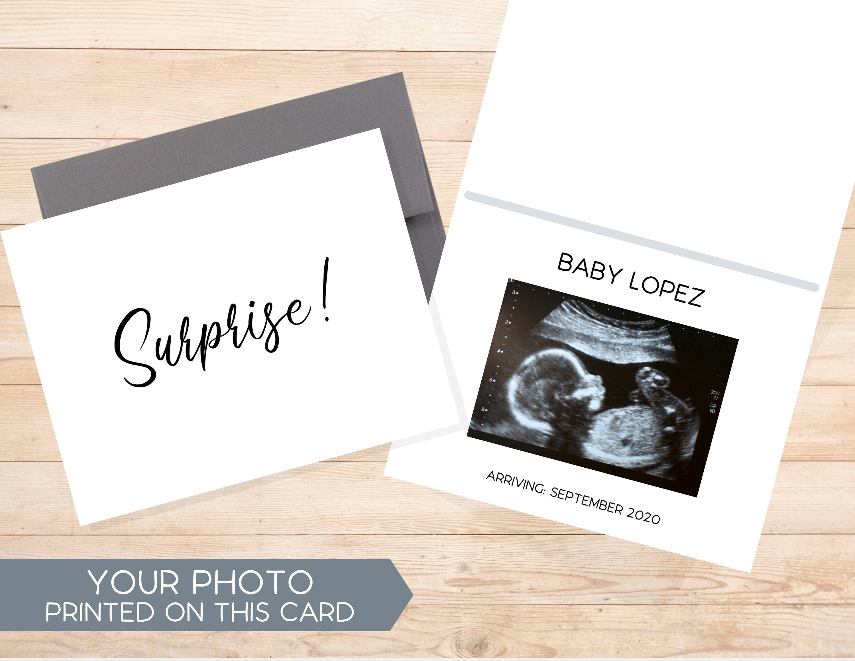 Custom Ultrasound Baby Announcement Card Sonogram - Etsy