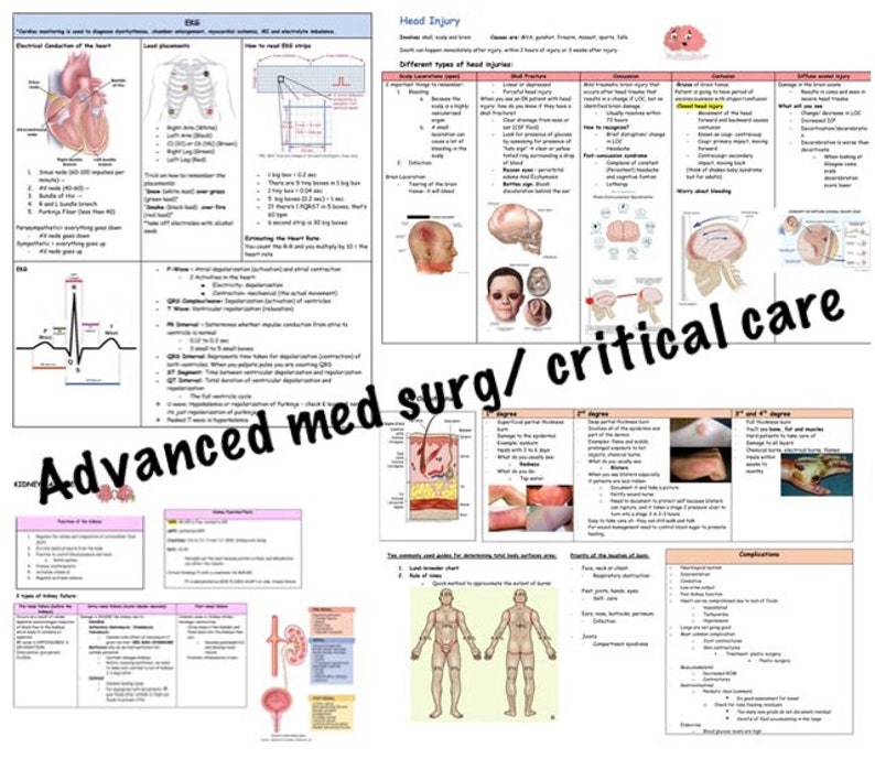 67 Pages Advanced Med-surg Critical Care Digital Notes for - Etsy