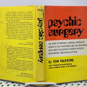 Psychic Surgery by Tom Valentine Vintage Hardcover - Etsy