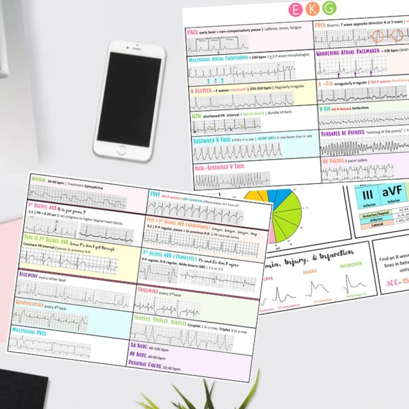 Ekg Nclex Cheat Sheet - Etsy