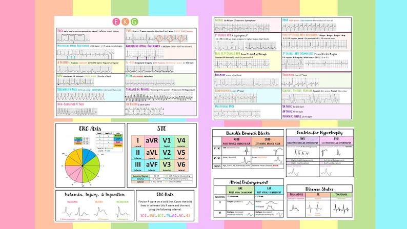 Ultimate EKG Review & Rhythm Interpretation- Medical Study Guides ...