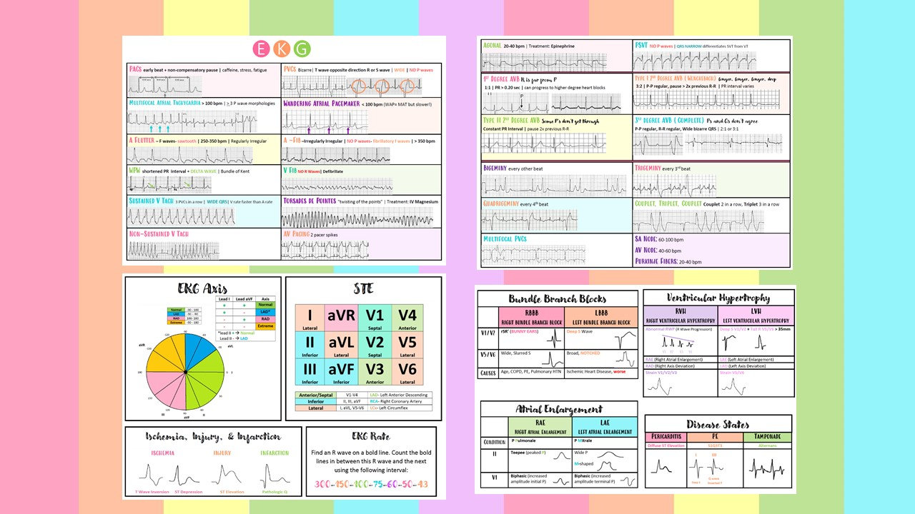 Ultimate EKG Review & Rhythm Interpretation- Medical Study Guides ...