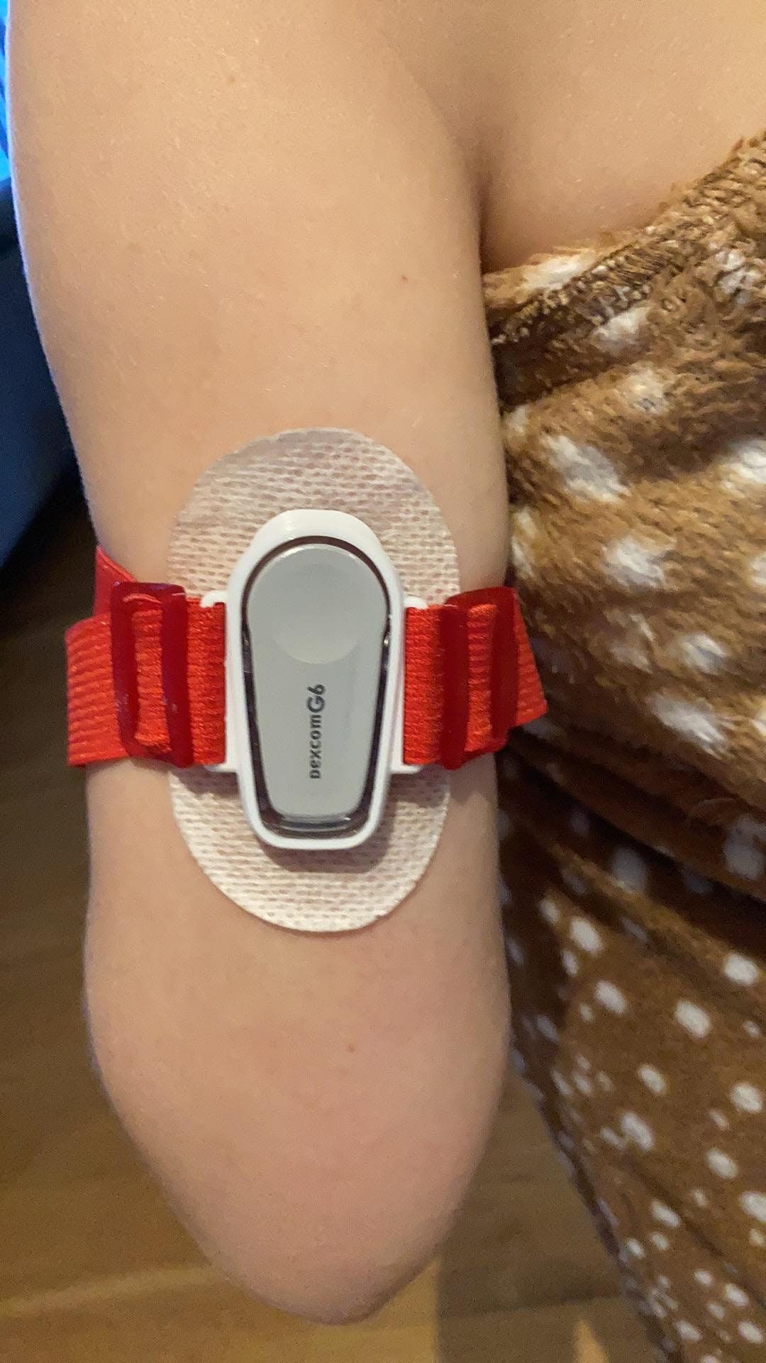 Armband for Dexcom G6 - Etsy