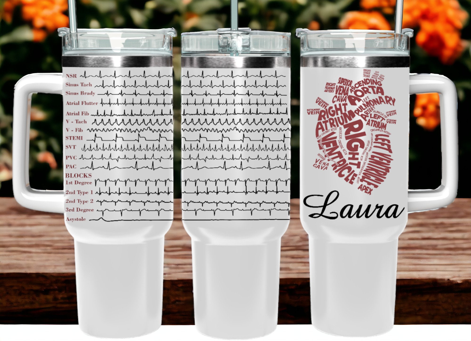 EKG Rhythms Acls Cardiac Tumbler, CVICU, CCU Telemetry Nurse Gift ...