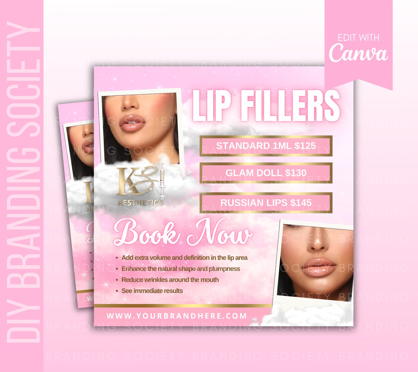 Lip Fillers Flyers Hyaluron Flyer Botox Flyer Facial - Etsy UK