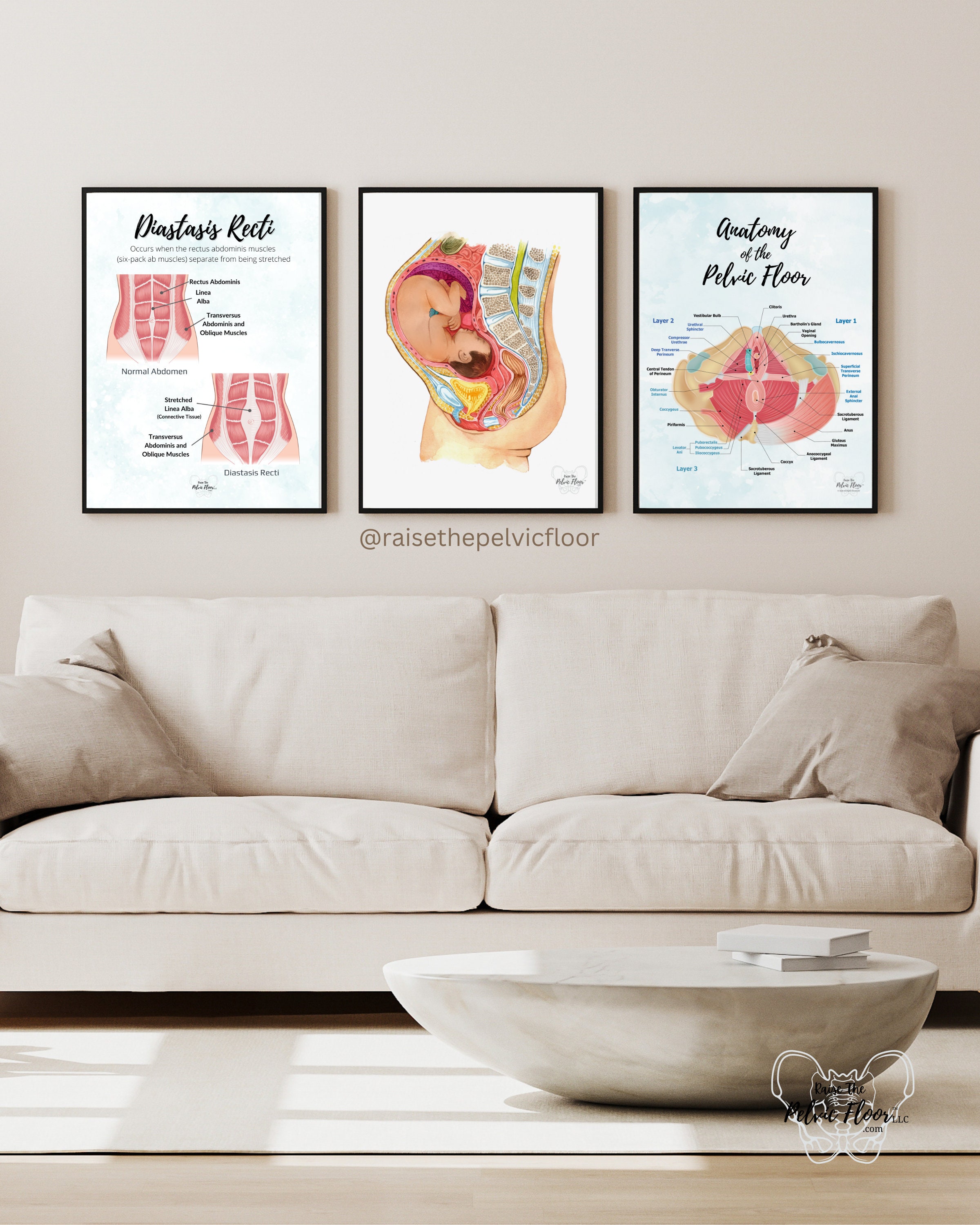 Diastasis Recti Pelvic Floor Art Poster | Postpartum, Pregnancy, Pelvic ...