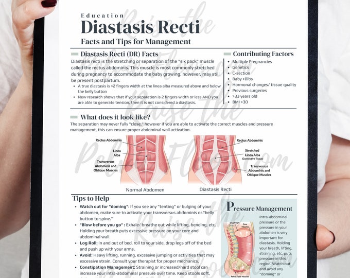 Diastasis Recti Patient Education Handout PDF Digital Download ...