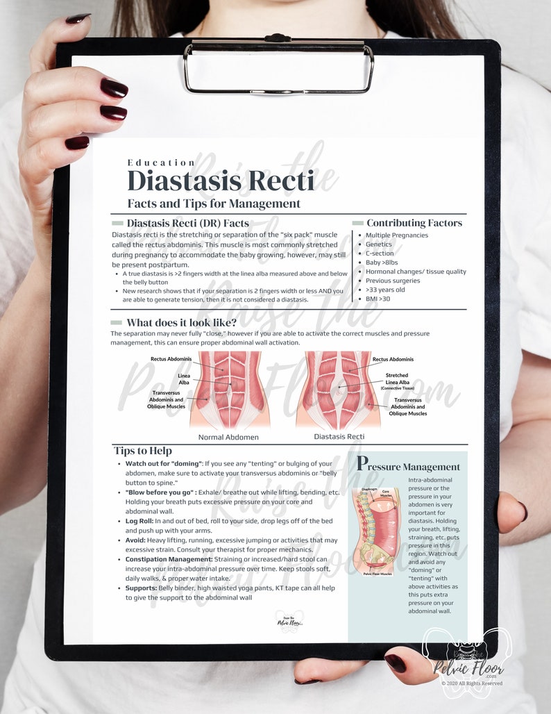 Diastasis Recti Patient Education Handout PDF Digital Download ...