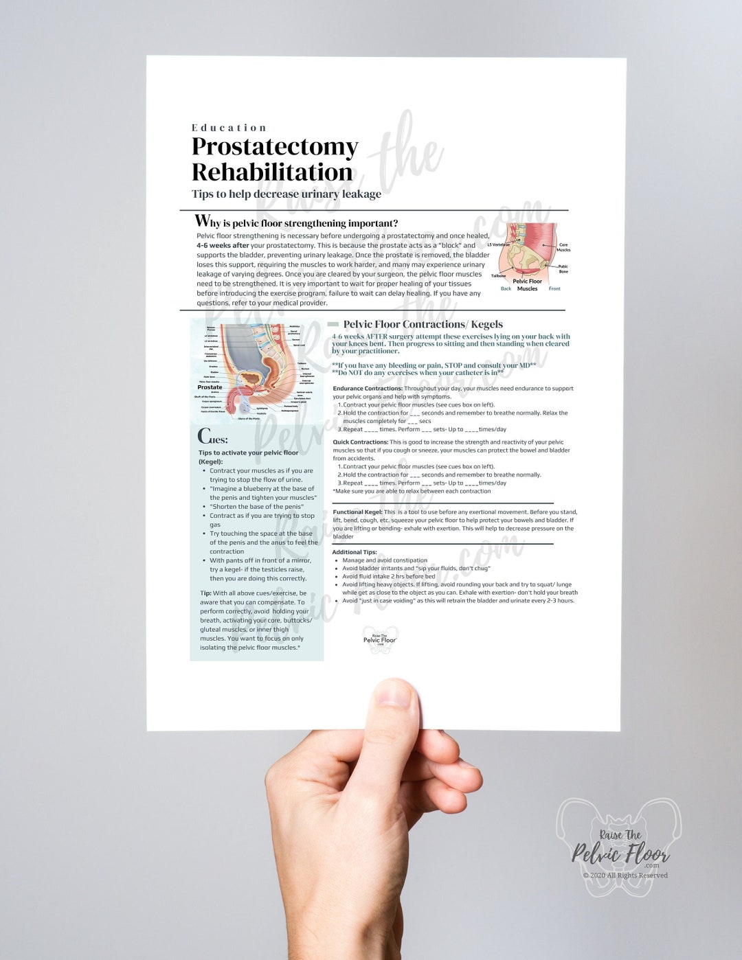 Prostatectomy Rehabilitation *digital Download* Patient Education ...