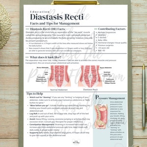 Diastasis Recti Patient Education Handout PDF Digital Download ...