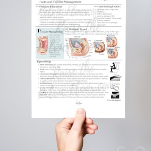 DIGITAL DOWNLOAD* Prolapse Patient Education Handout | Rectocele ...