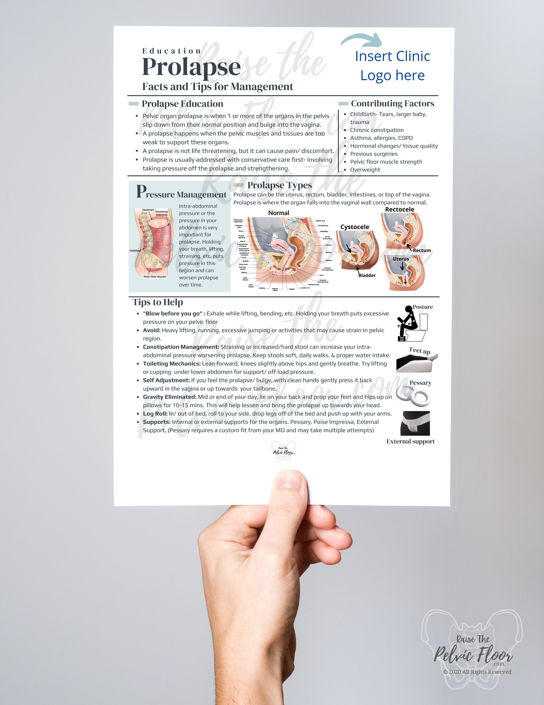 DIGITAL DOWNLOAD* Prolapse Patient Education Handout | Rectocele ...