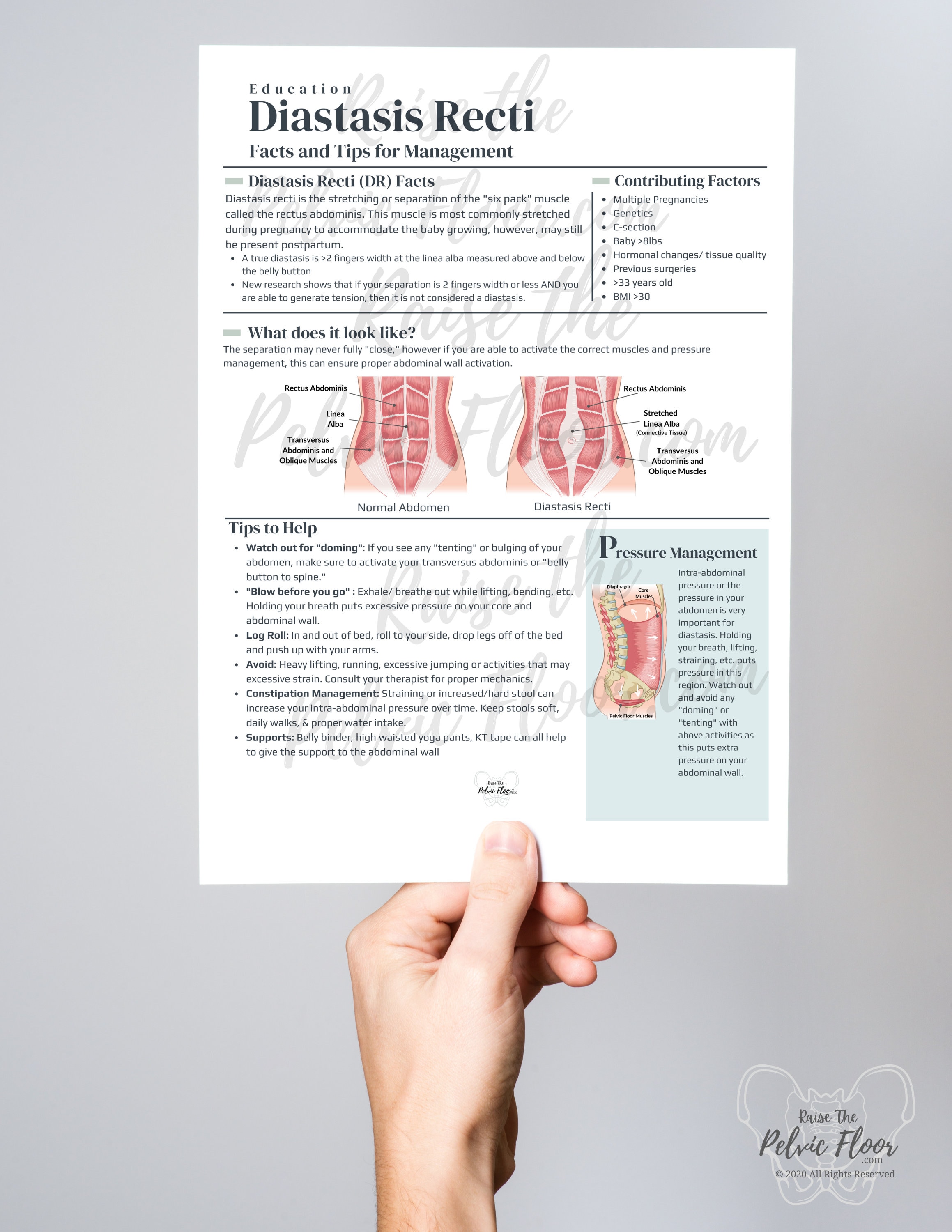 Diastasis Recti Patient Education Handout PDF Digital Download ...