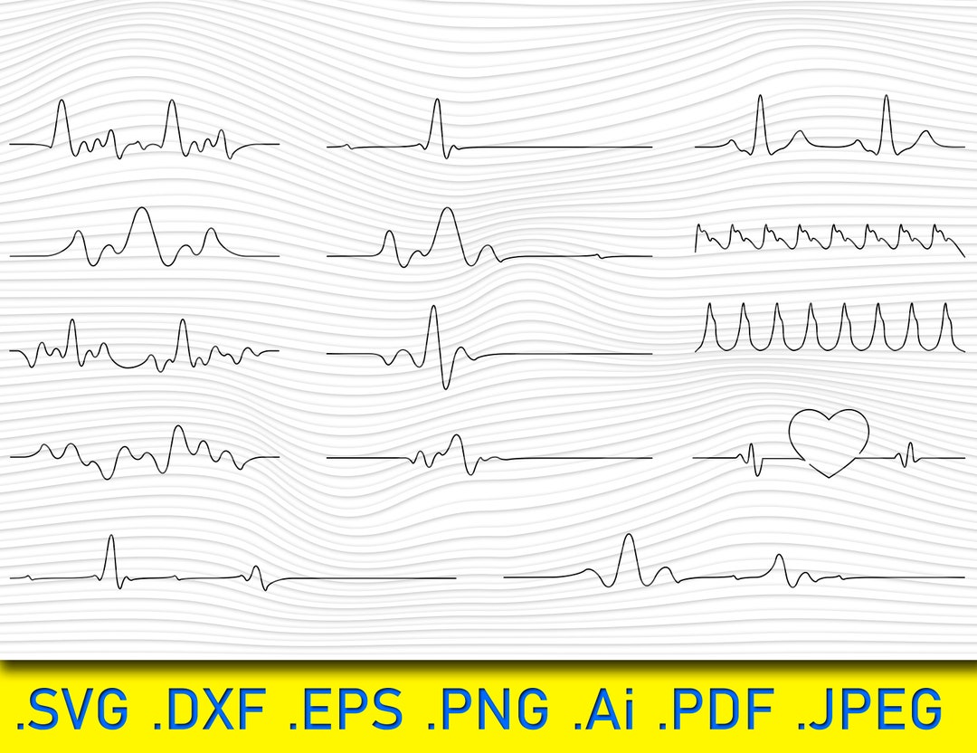 Heartbeat Svg, Heartbeat Pulse Svg, Heartbeat Line, Cardiogram, Medical ...