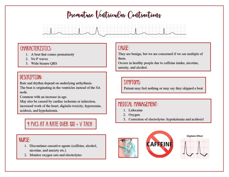 EKG Rhythms Nursing Bundle - Cheat Sheets - Etsy