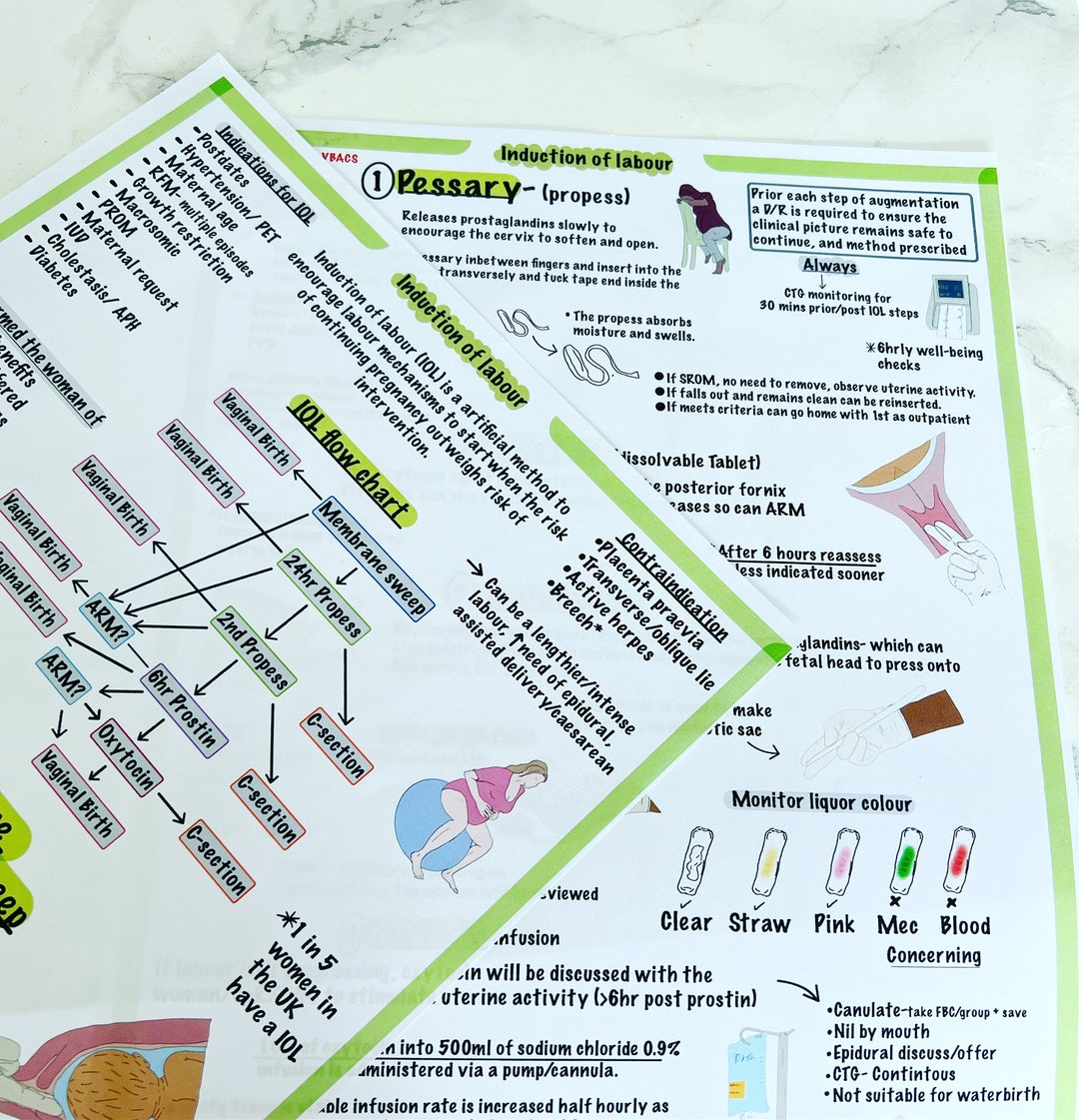 Induction of Labour Downloadable Pdf Midwifery Revision Poster - Etsy