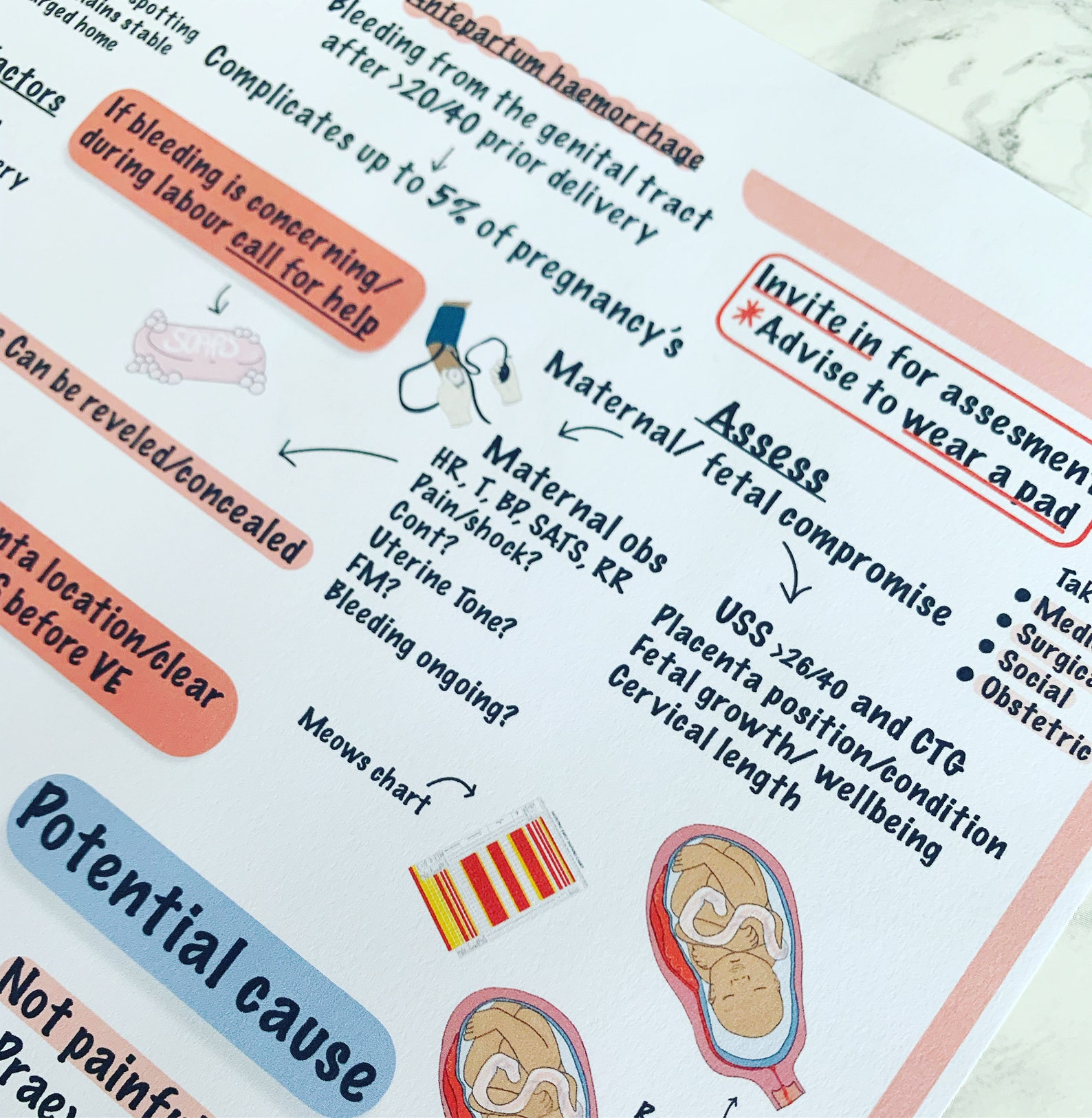 Emergency Bundle X8 Downloadable Pdf Midwifery Revision Posters - Etsy UK