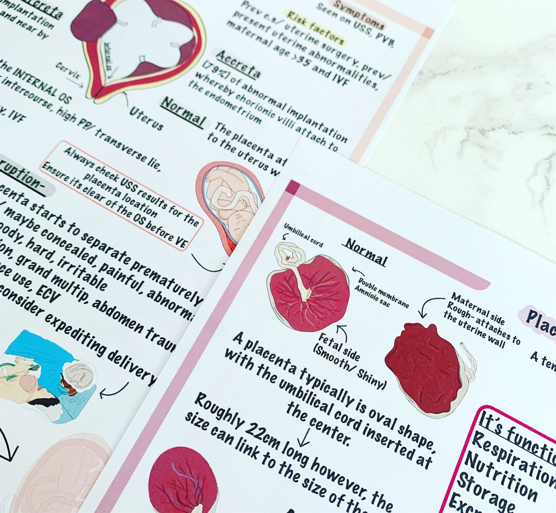 2x, Placentas and Abnormalities Bundle Pdf Midwifery Revision Poster - Etsy