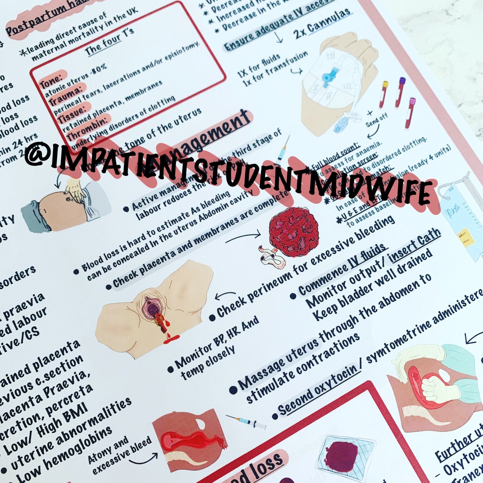 Wall Décor LABOUR 3rd STAGE Downloadable pdf revision Midwifery ...