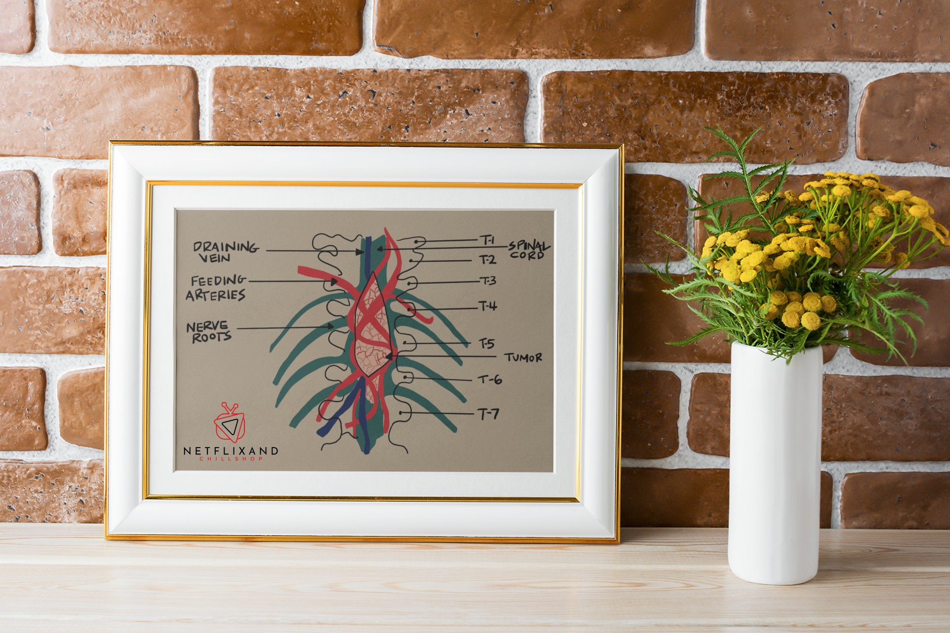 Greys Anatomy Tumor Print - Derek Shepherd, TV Show Print, Mcdreamy ...