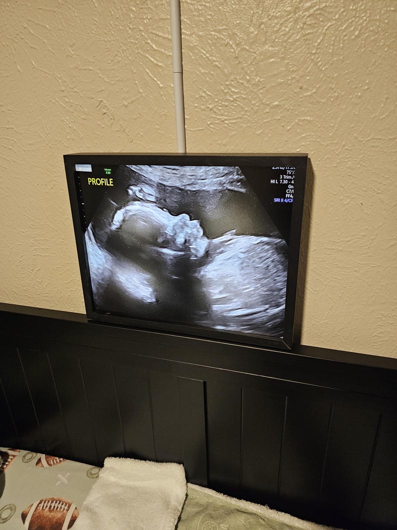 LED Light Box Baby Ultrasound Baby Photo Custom Graphic Baby Shower ...