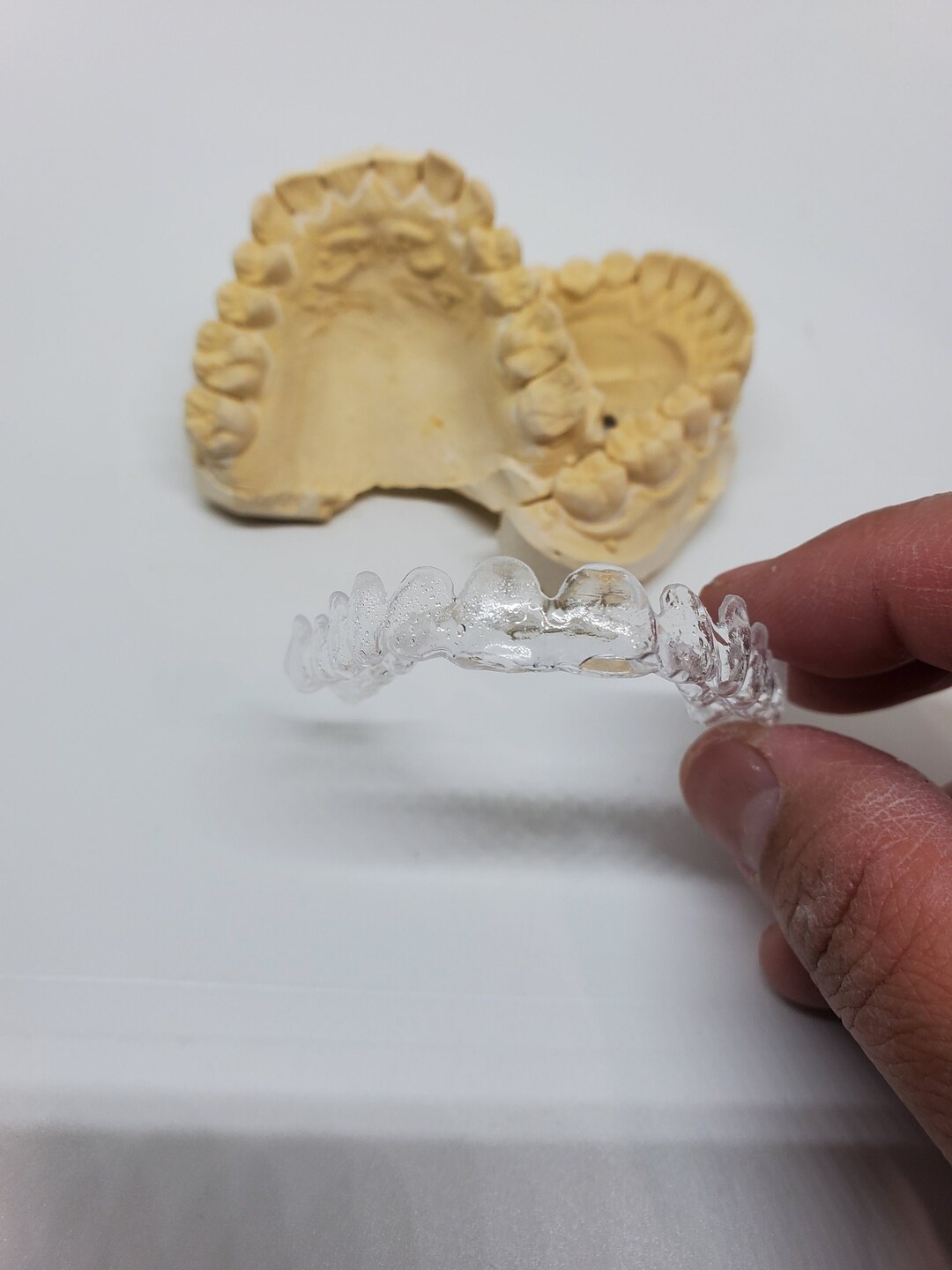 Custom Clear essix Retainer - Etsy