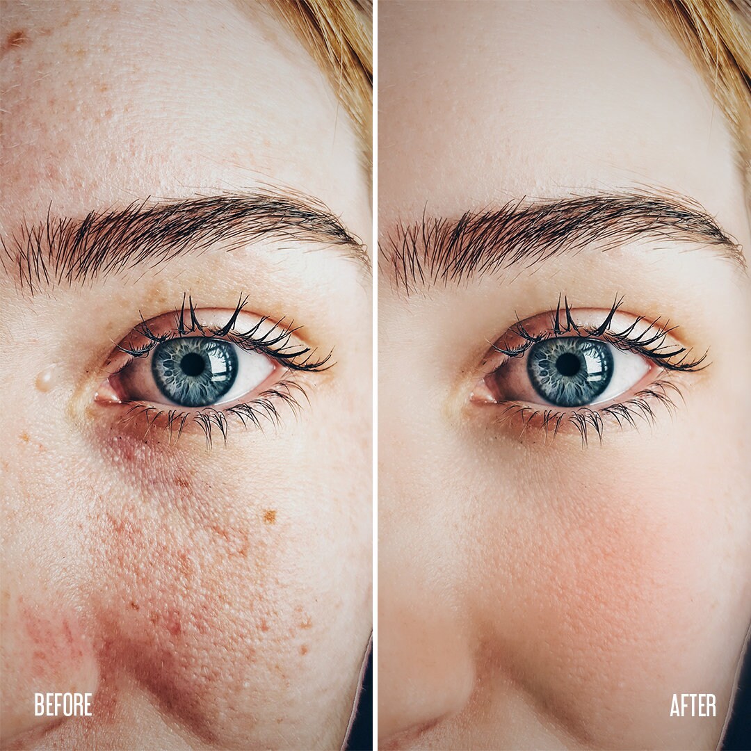 High End Photo Retouching, Portrait, Female, Male, Blemishes ...