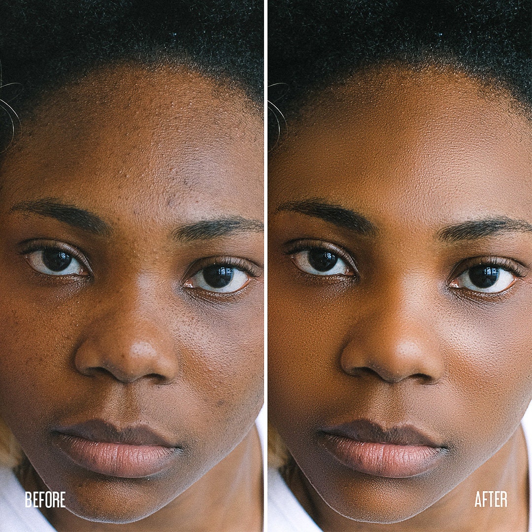 High End Photo Retouching, Portrait, Female, Male, Blemishes ...