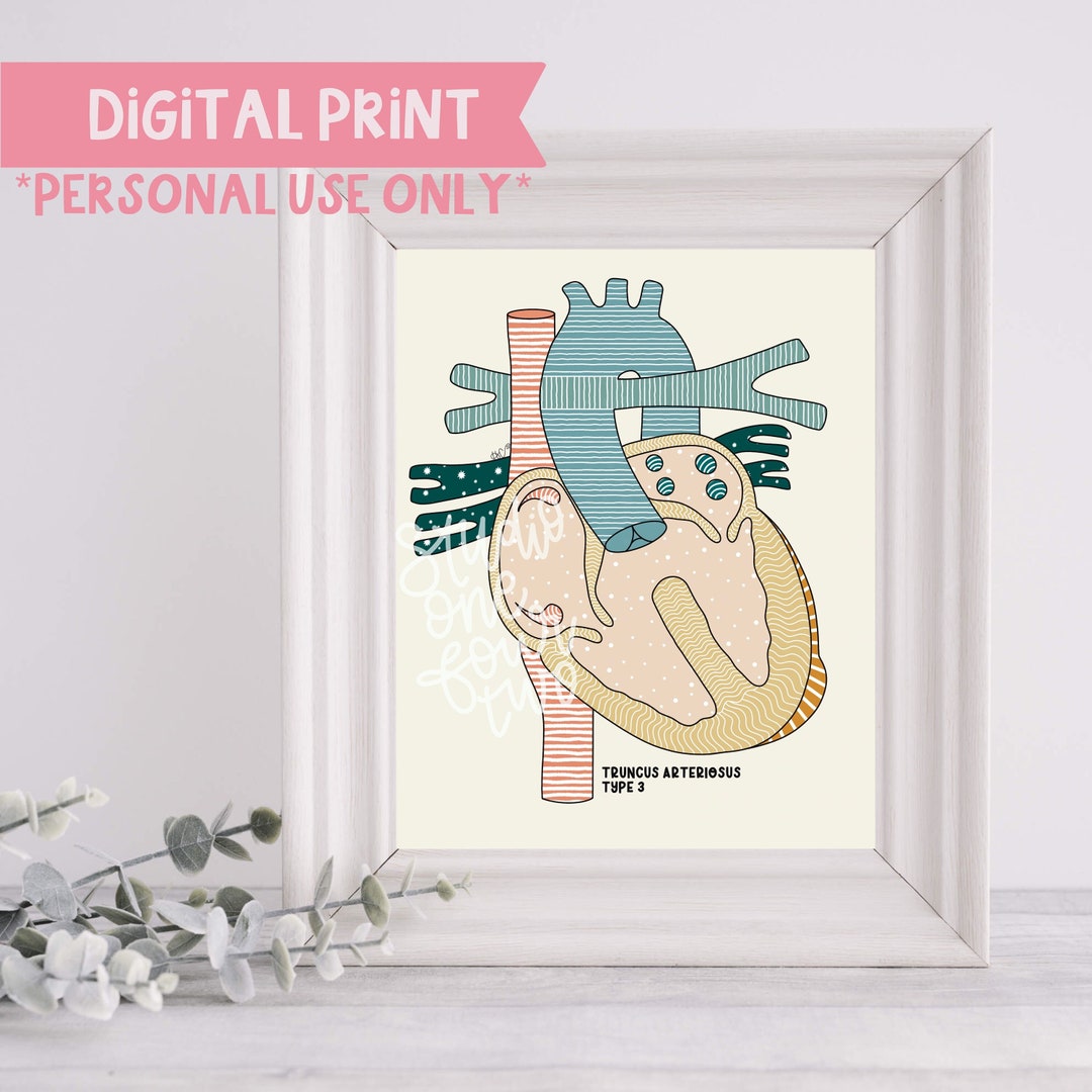 Truncus Arteriosus Type 3 Digital Print | Anatomical Heart Illustration ...