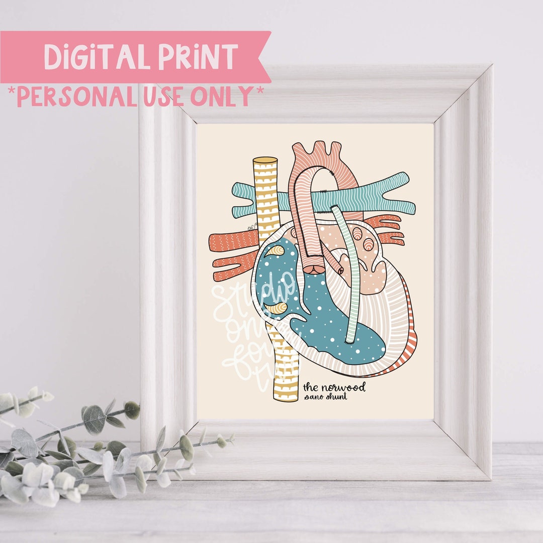 Sano Shunt Norwood Digital Print | HLHS | Anatomical Heart Illustration ...