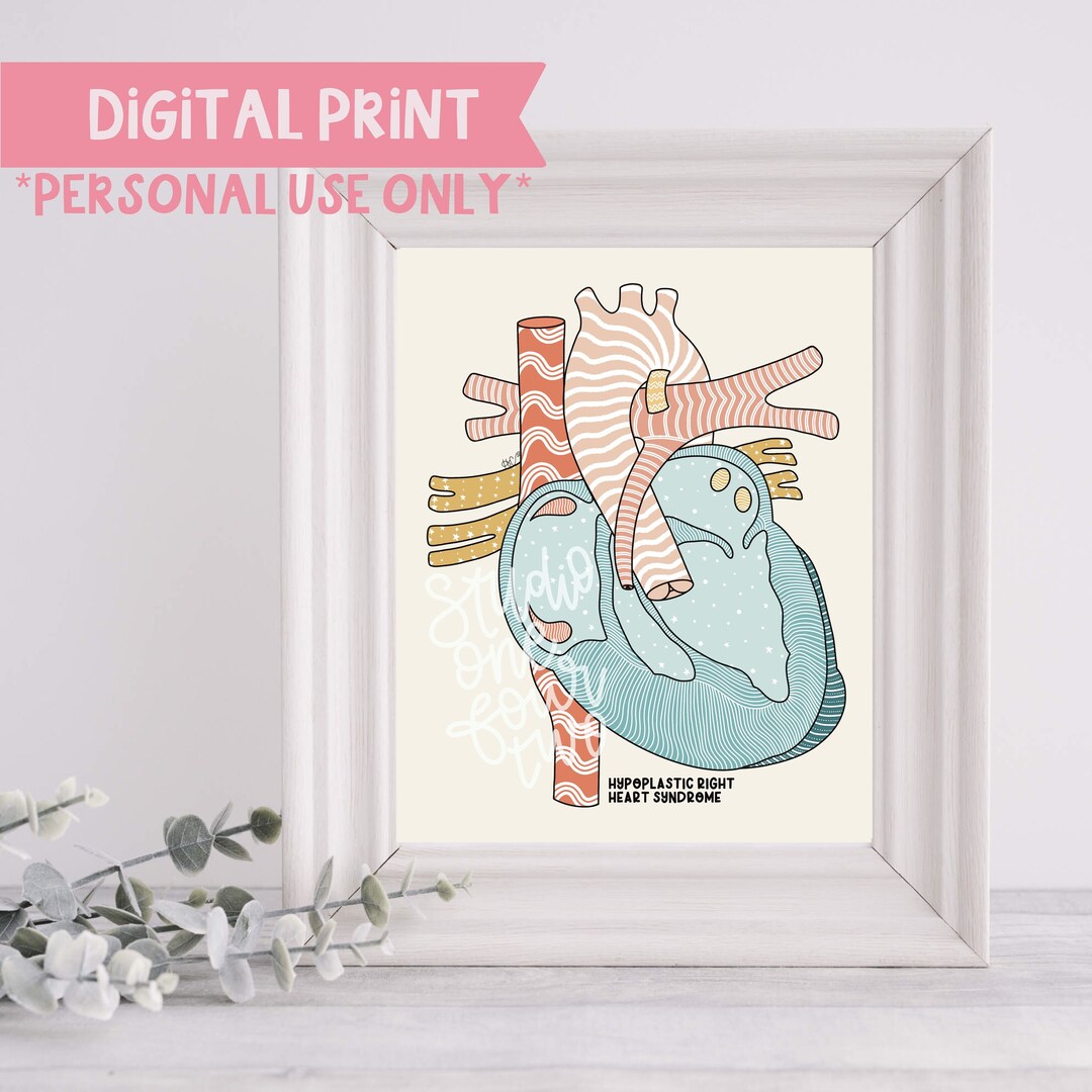 HRHS Surgical Series Digital Print Bundle | Anatomical Heart ...