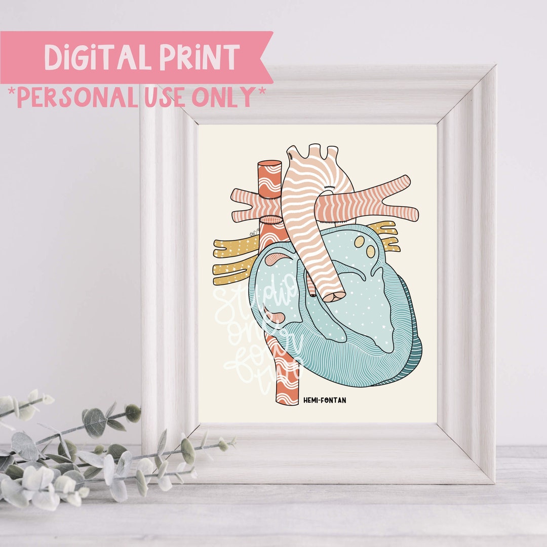 Hemi Fontan Digital Print | HRHS | Anatomical Heart Illustration ...