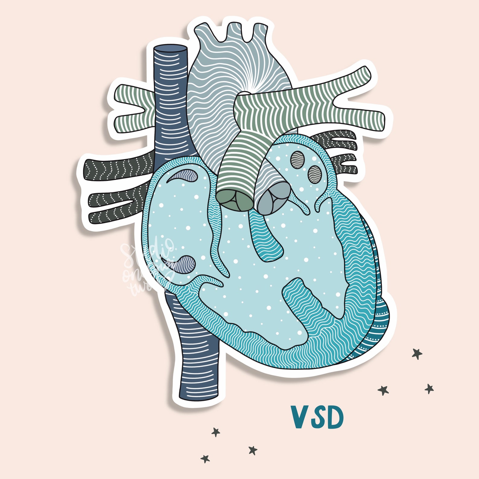 VSD Sticker | Ventricular Septal Defect | CHD Sticker - Etsy