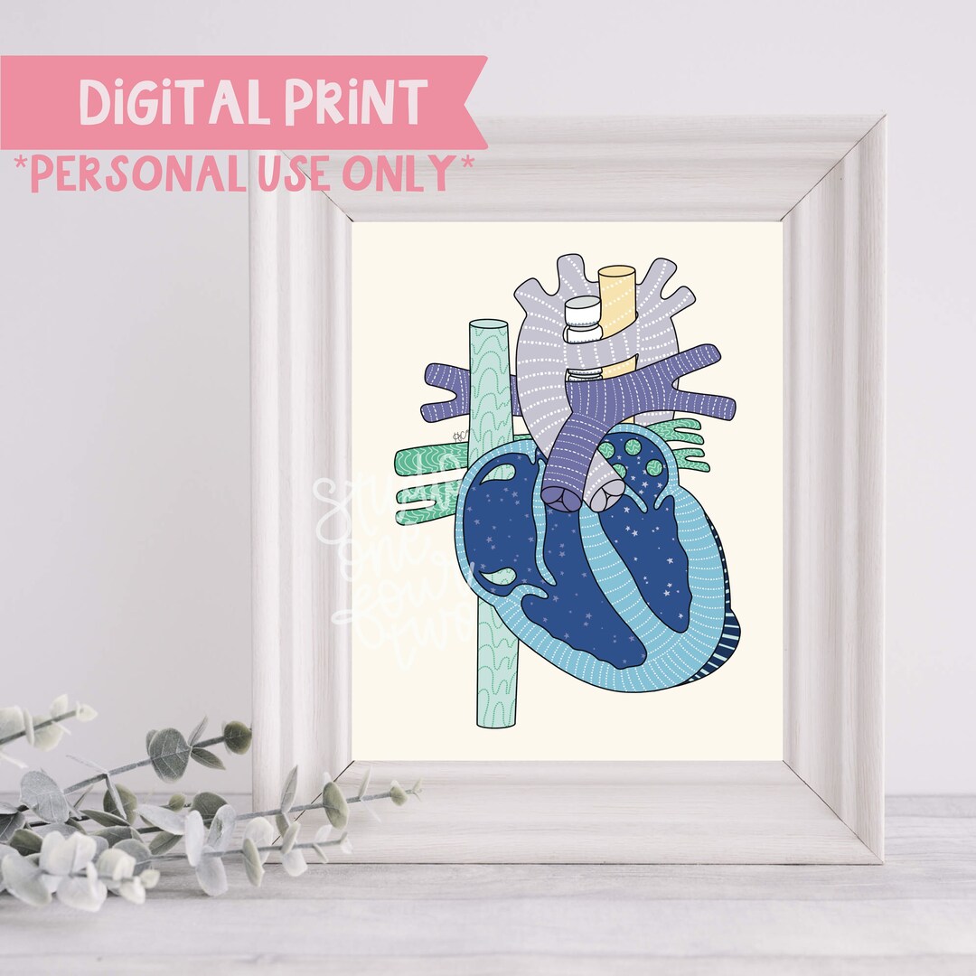 Double Aortic Arch Digital Print | Anatomical Heart Illustration ...