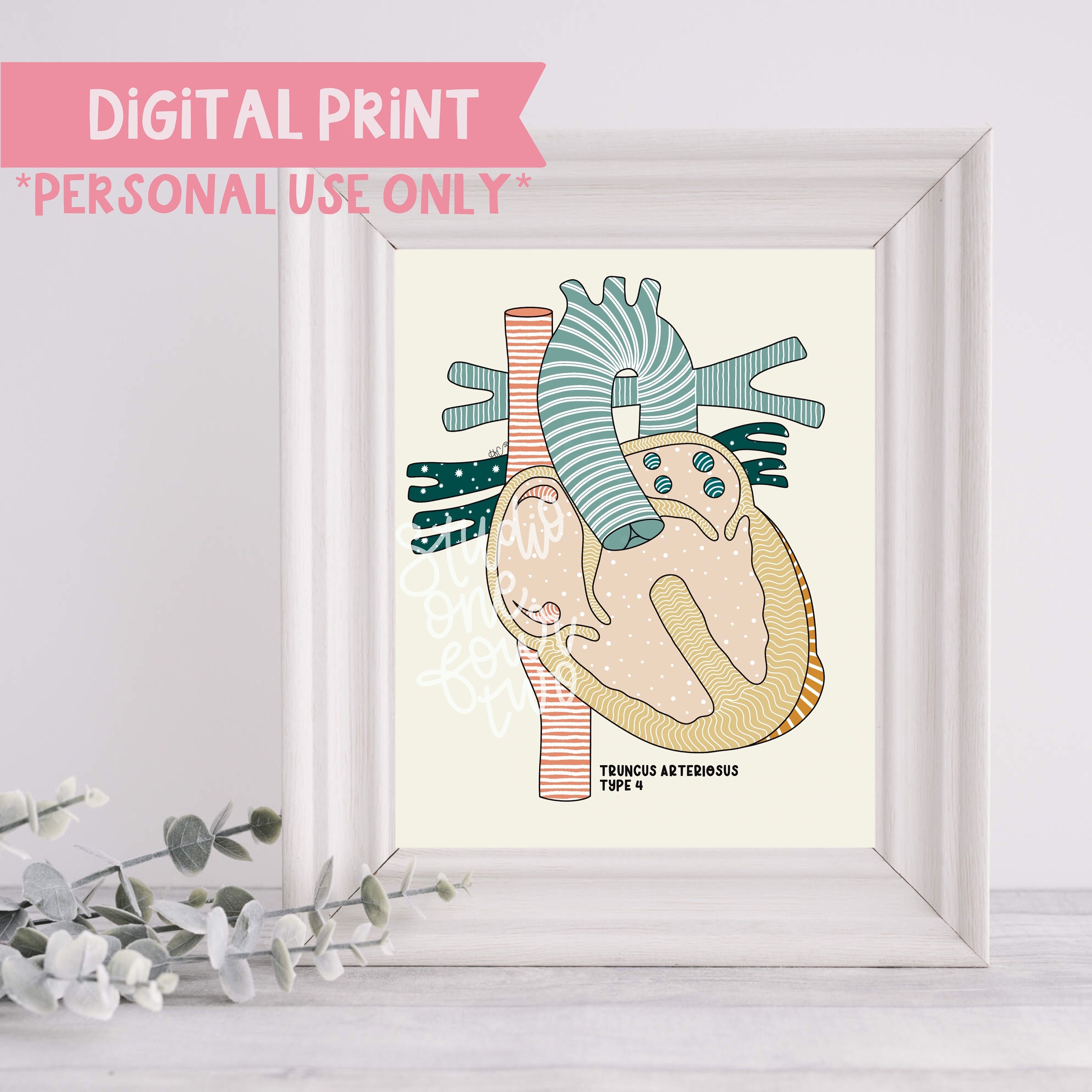 How Many Truncus Types Are There