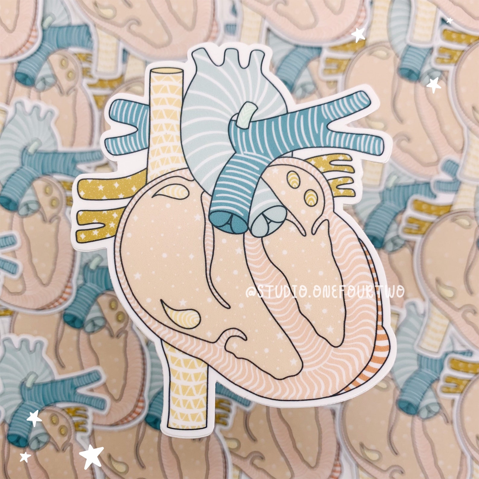 Ebsteins Anomaly Sticker CHD Sticker | Etsy