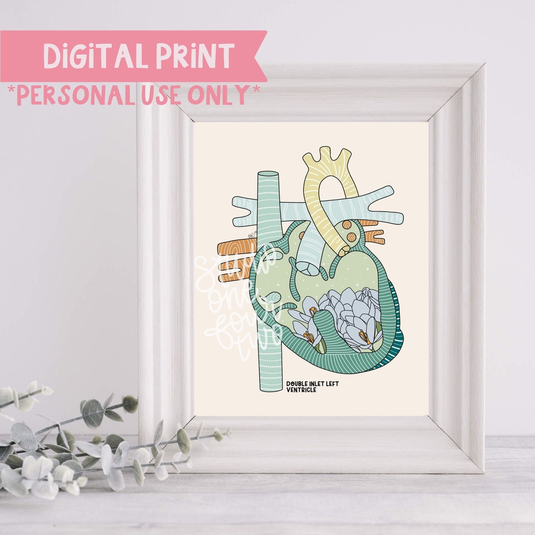 DILV Surgical Series Digital Prints | Anatomical Heart Illustration ...
