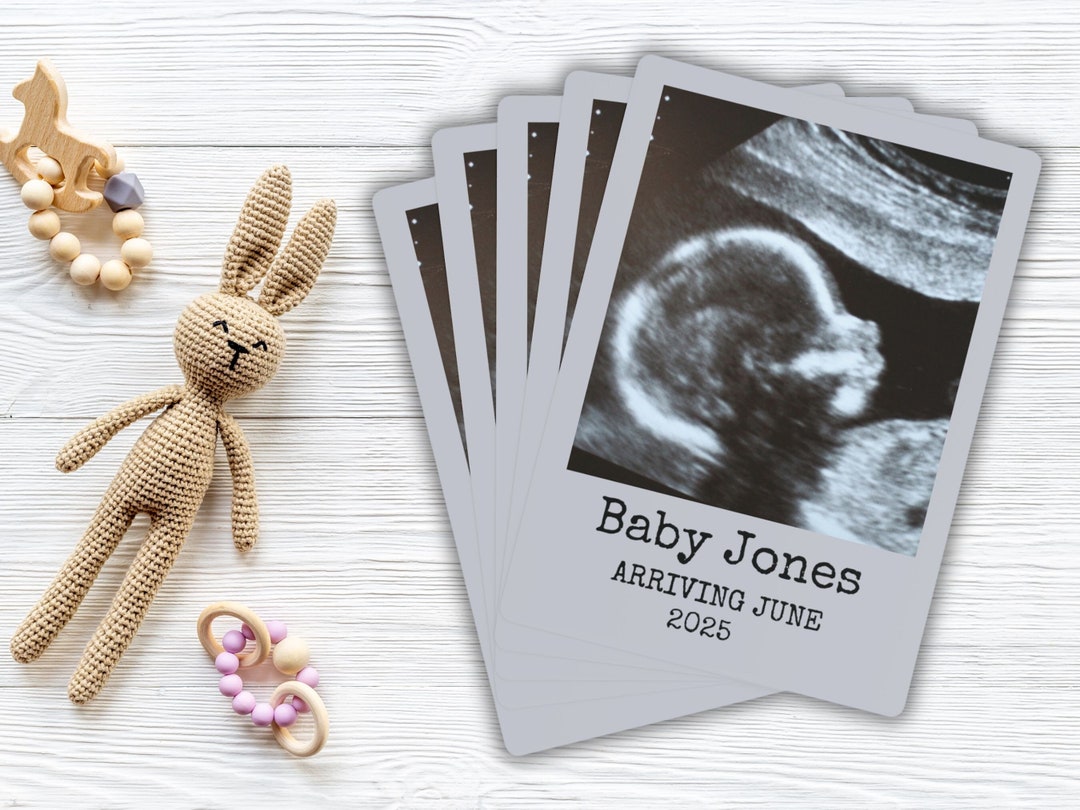 New Baby Ultrasound Gift, Personalised Sonogram Photo Playing Cards ...