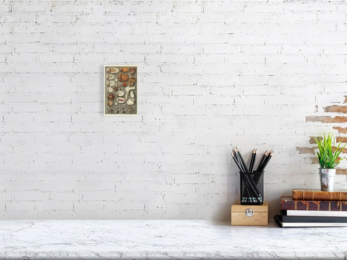 Kidney and Bladder Stones by Max Brödel 1909 - Etsy