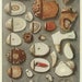 Kidney and Bladder Stones by Max Brödel 1909 - Etsy