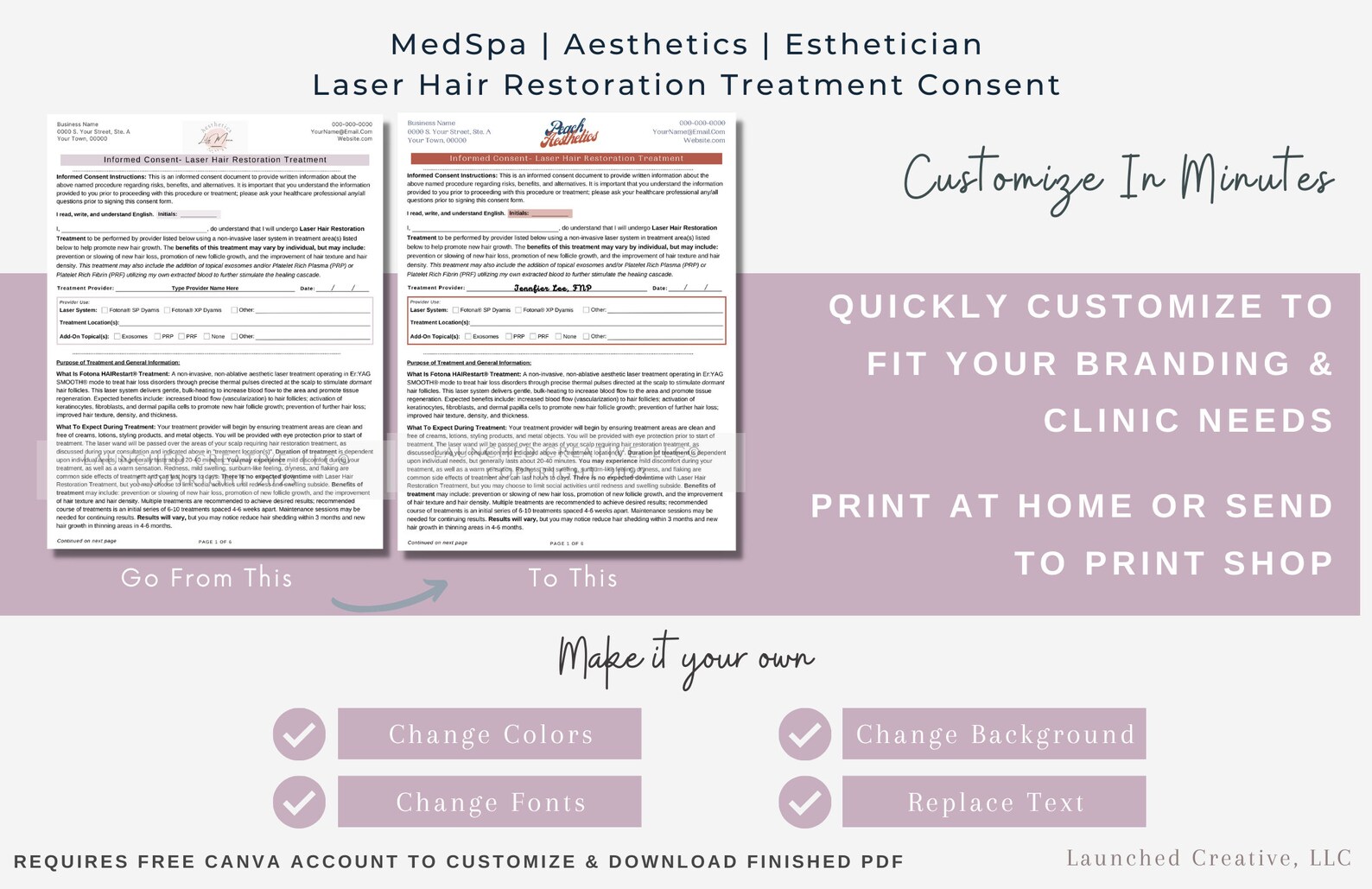 Laser Hair Restoration Consent Form Template | Fotona Hairestart ...