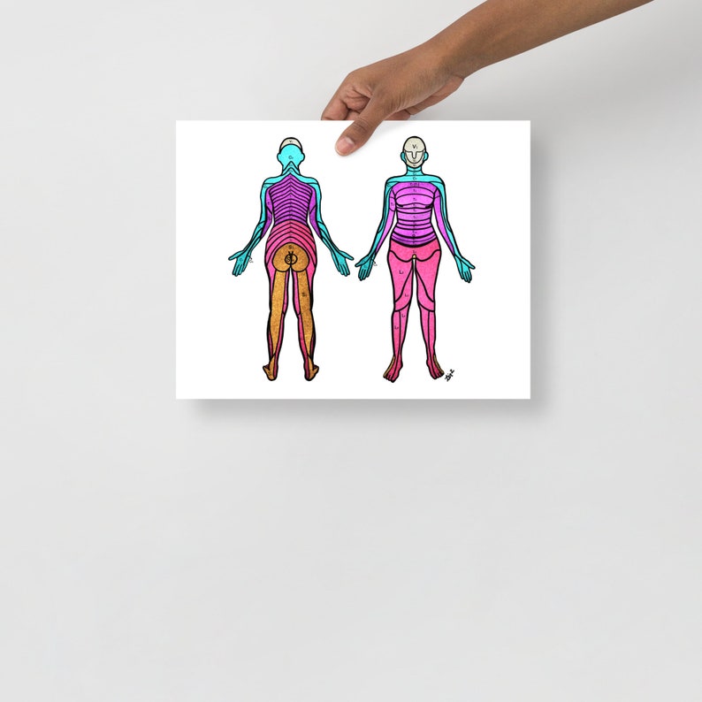 Dermatomes Neurology Poster - Etsy