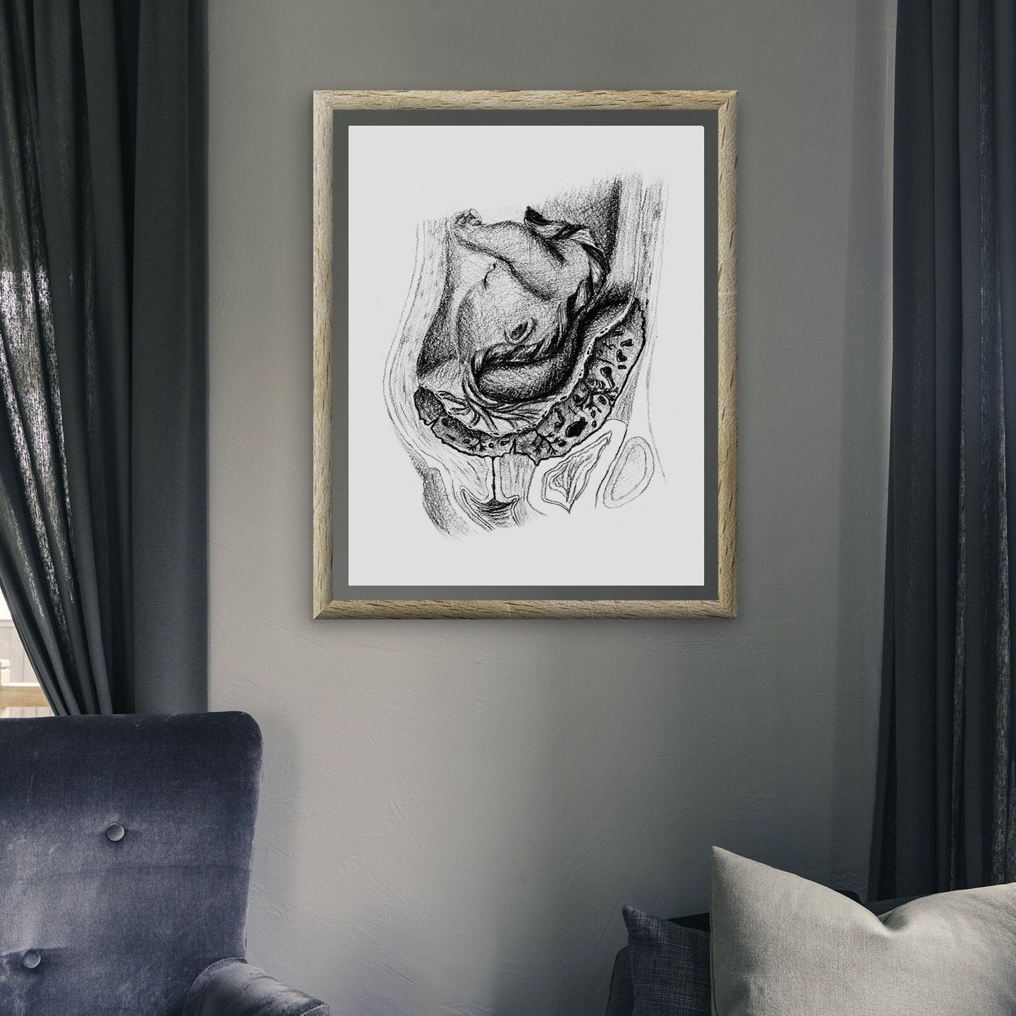 Placenta Previa Illustrations Set of Two: Birth/doula/midwife Art ...